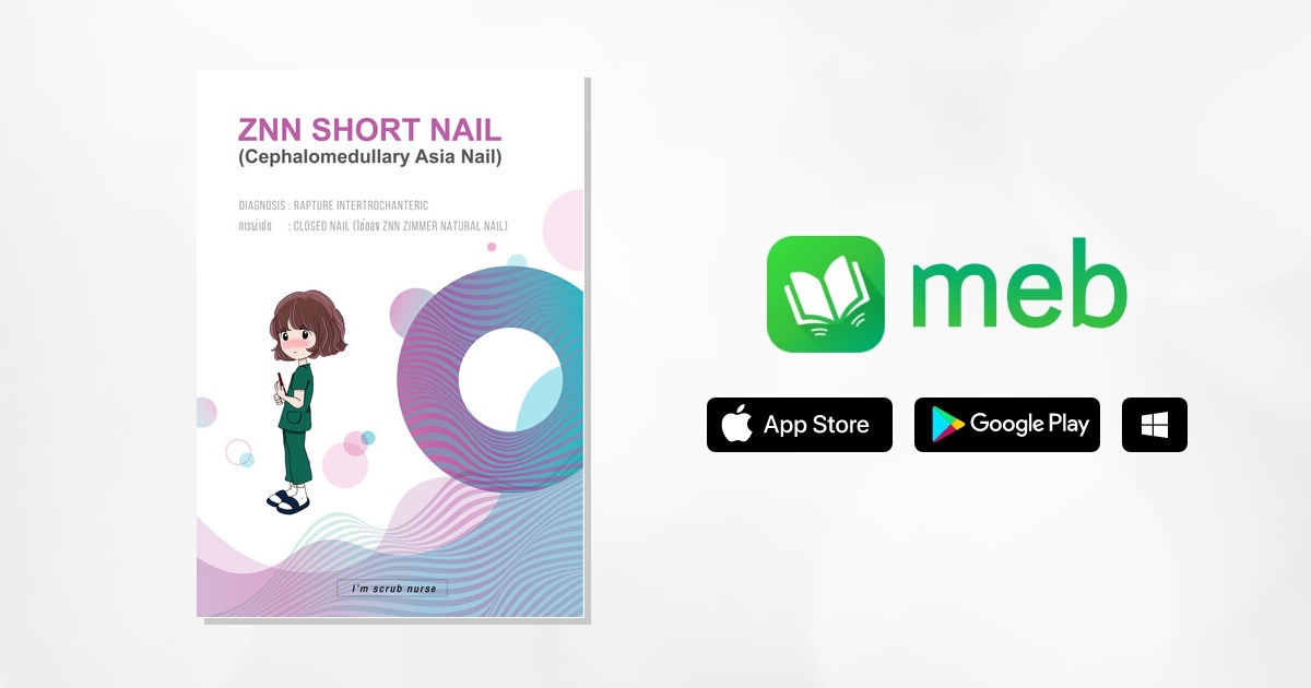 ZNN SHORT NAIL (Cephalomedullary Asia Nail):: e-book หนังสือ โดย I'm scrub nurse